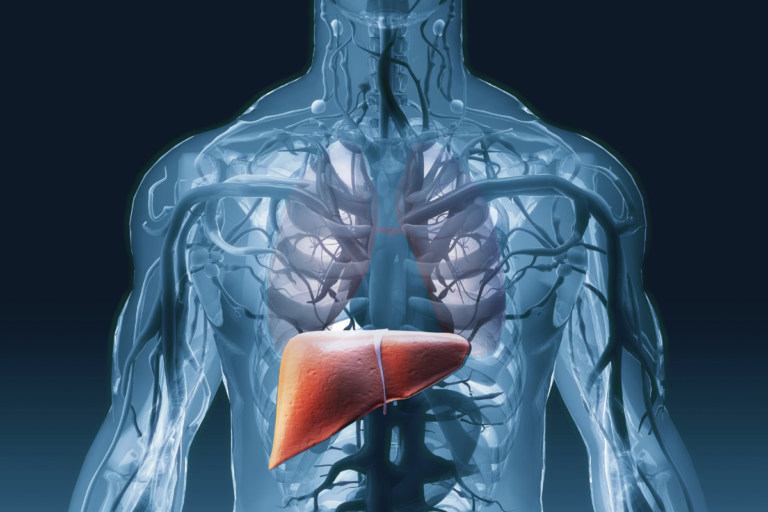 Liver Disease: Symptoms, Causes, Diagnosis Treatment